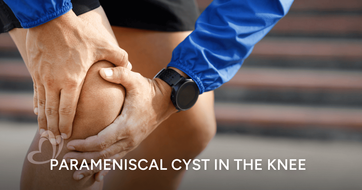 Parameniscal Cyst in the Knee: What You Need to Know | Thomson Medical
