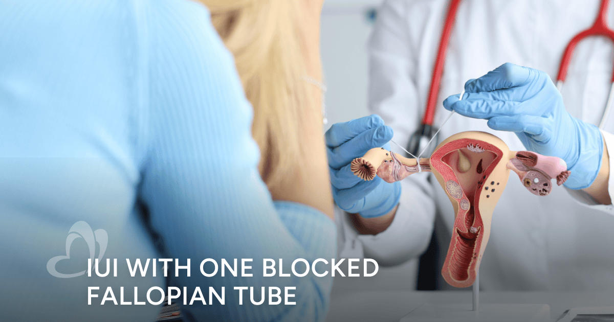IUI with One Blocked Fallopian Tube: What You Need to Know | Thomson ...