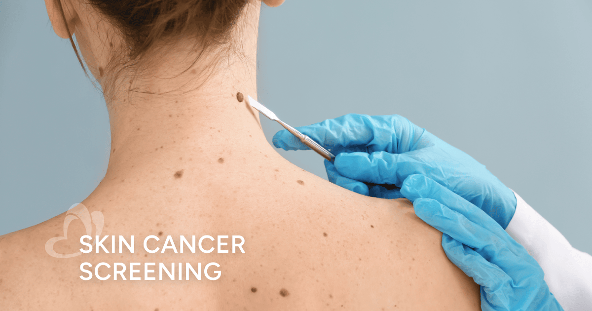 Skin Cancer Screening | Thomson Medical