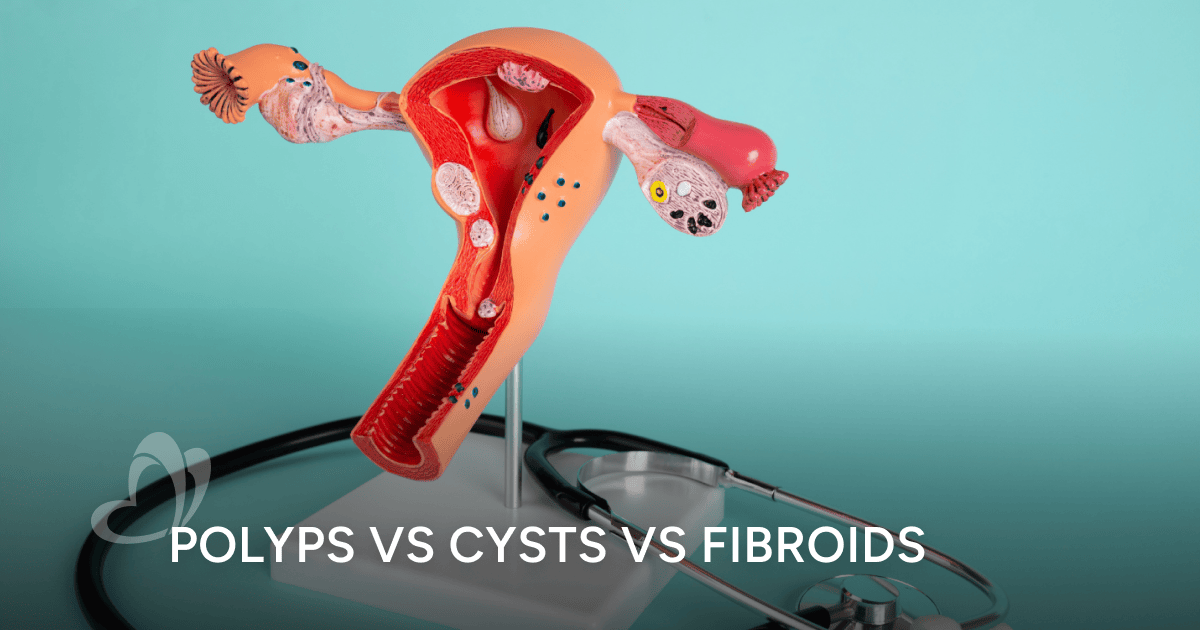 Polyps vs Cysts vs Fibroids in Women: What's the Difference? | Thomson ...