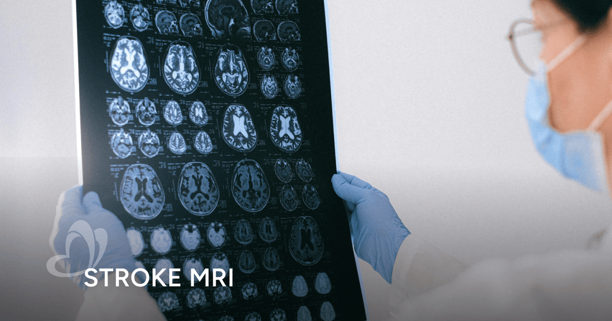 Stroke MRI: Detection, Preparation, and Treatment Explained | Thomson Medical