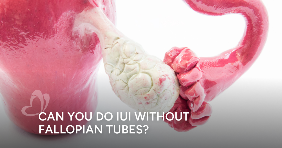 Can You Do IUI Without Fallopian Tubes? What You Need To Know | Thomson ...