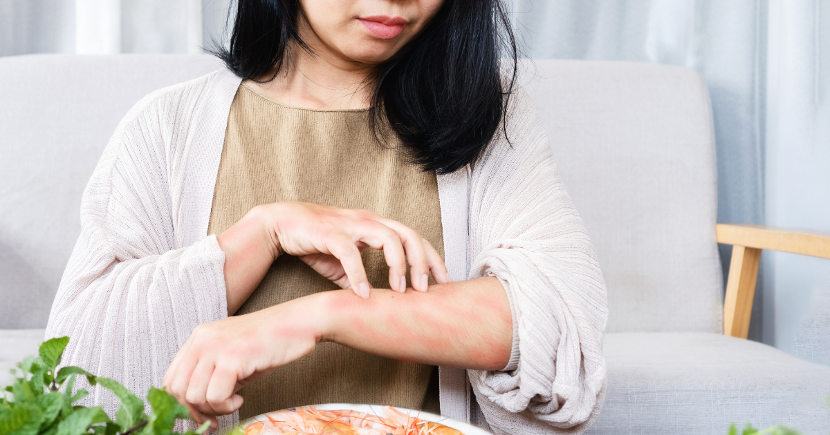 TCM Hives | Thomson Medical