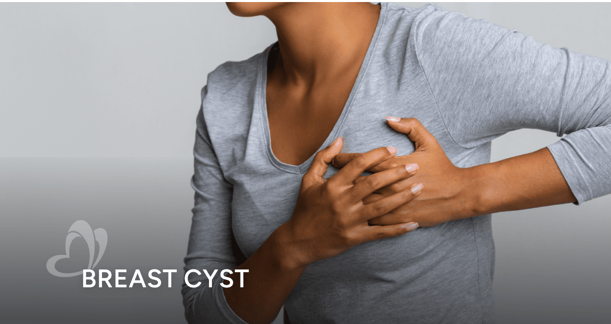 Breast Cyst: Symptoms, Causes, and Treatment Options | Thomson Medical
