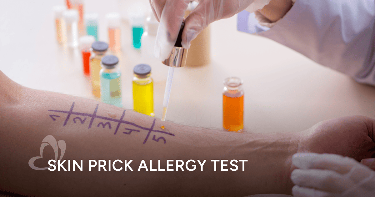 Skin Prick Allergy Test: Purpose, Procedure, and What to Expect ...