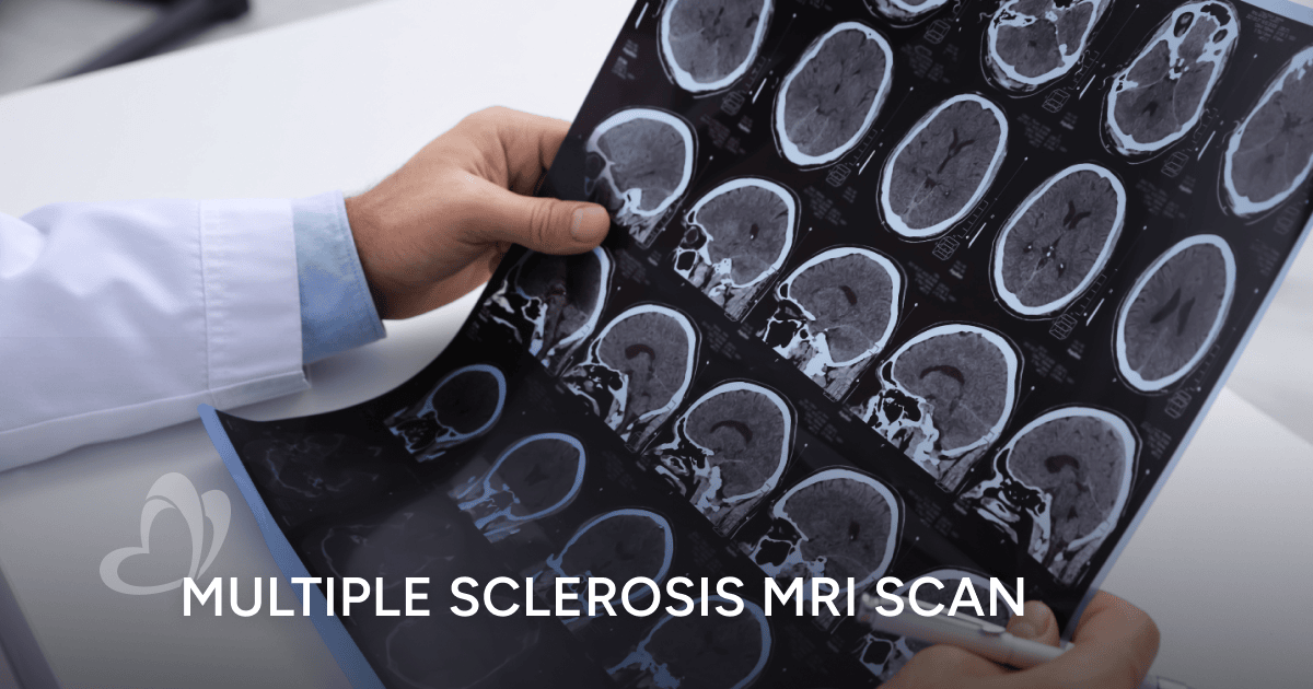 Multiple Sclerosis MRI Scan: How It Works and What to Expect | Thomson ...