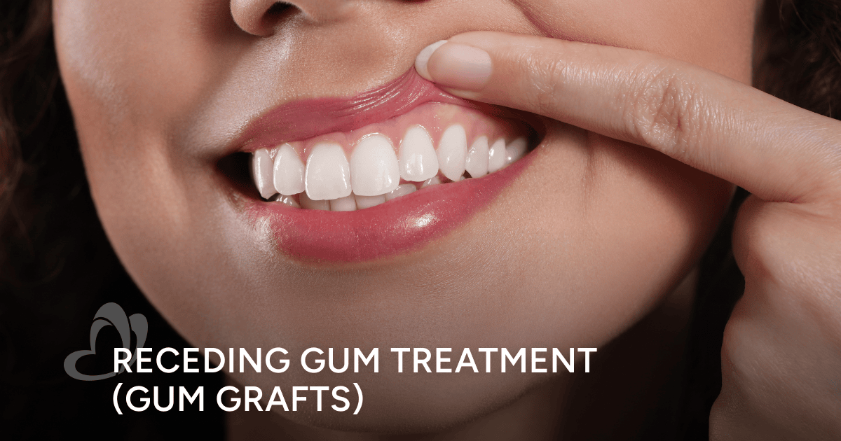 Receding Gum Treatment (Gum Grafts): What You Need to Know | Thomson ...