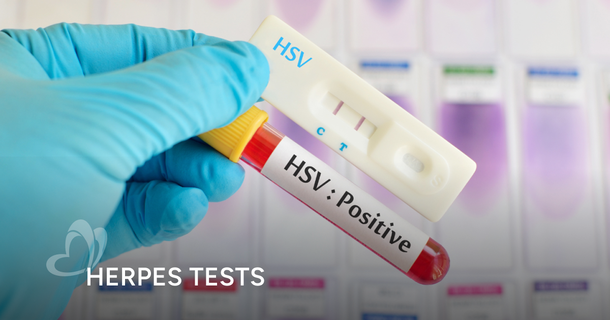 Herpes Testing in Singapore: Everything You Need To Know | Thomson Medical