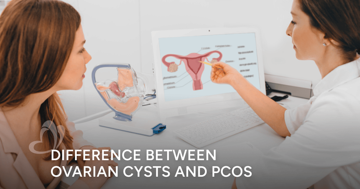 Difference Between Ovarian Cysts and PCOS: What You Need to Know ...
