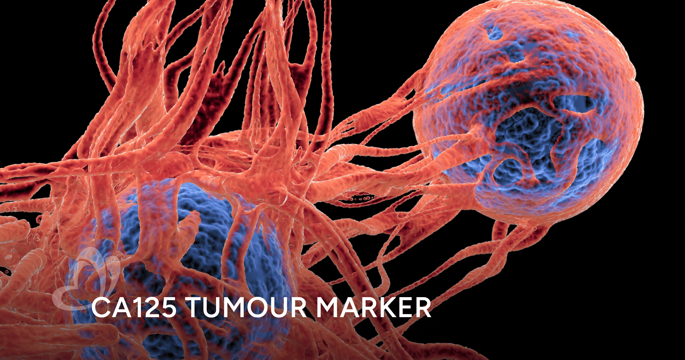 CA125 Tumour Marker Blood Test: Normal & Dangerous Range | Thomson Medical