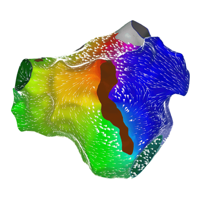 PENTARAY™ NAV ECO High Density Mapping Catheter | J&J MedTech US