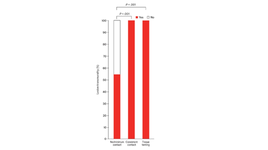 Pulsed field ablation (PFA) | J&J MedTech US