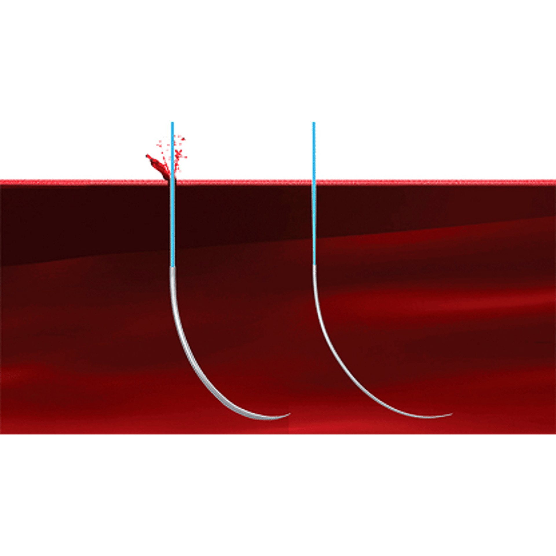 PROLENE™ Polypropylene Suture with HEMO-SEAL™ Technology | J&J MedTech US