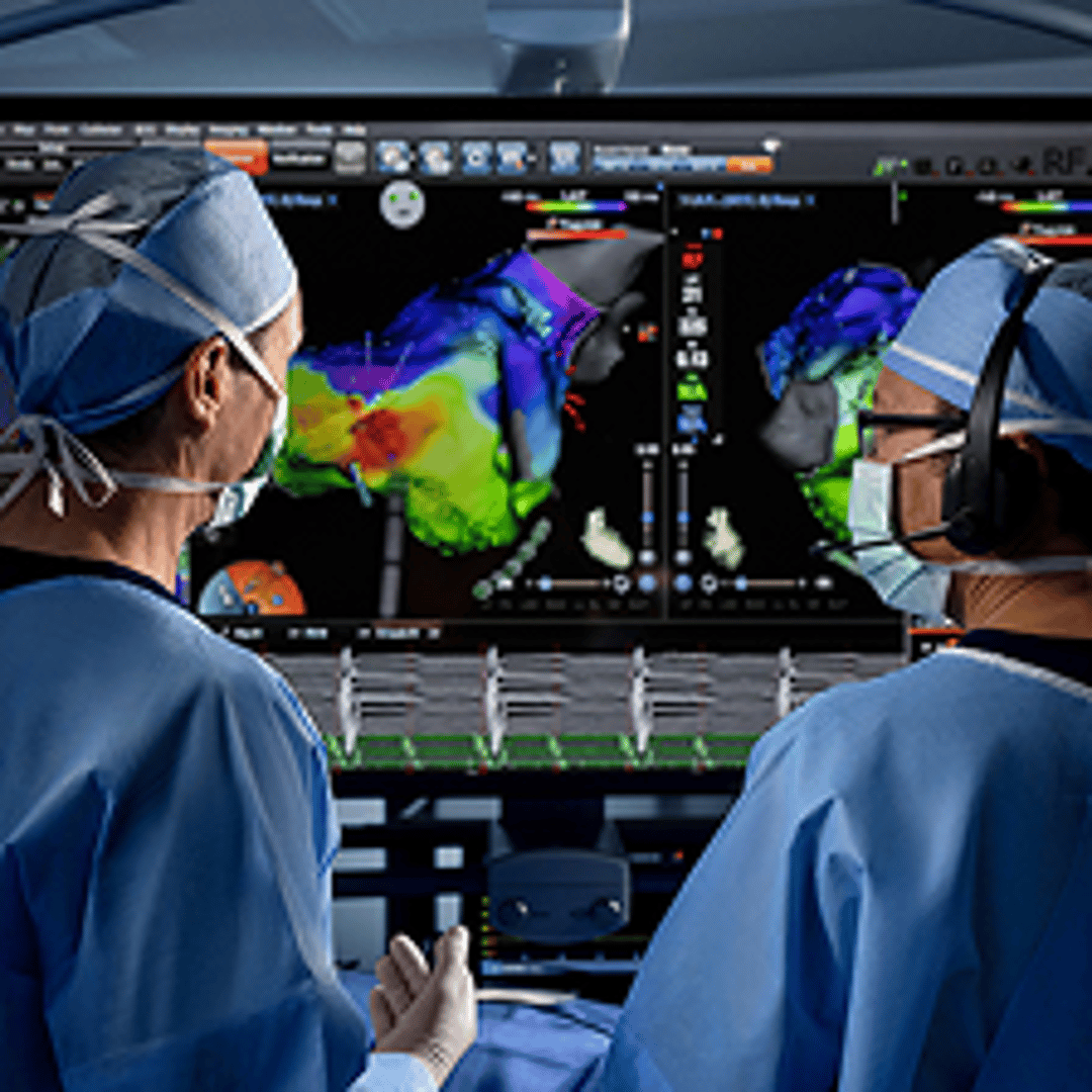 THERMOCOOL SMARTTOUCH™ SF Catheter | J&J MedTech US