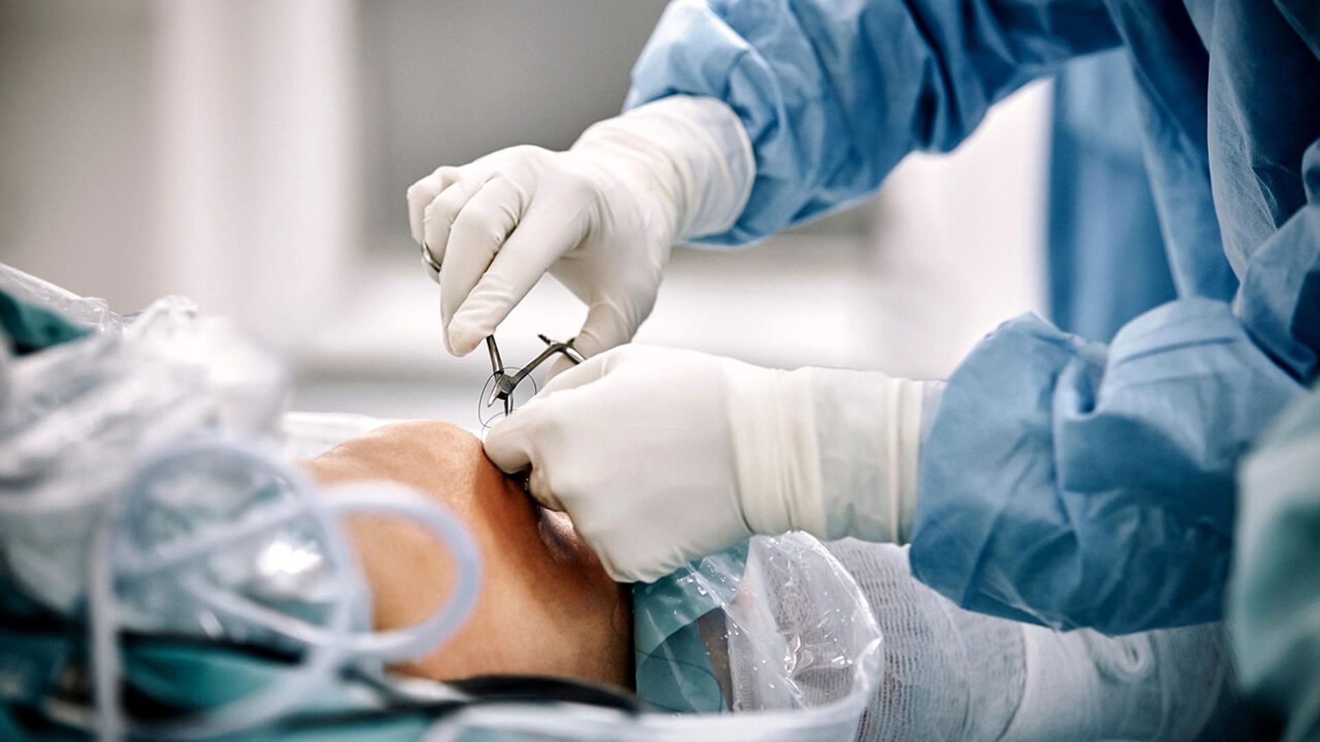 What’s the right indication for cement versus cementless implants? | J ...