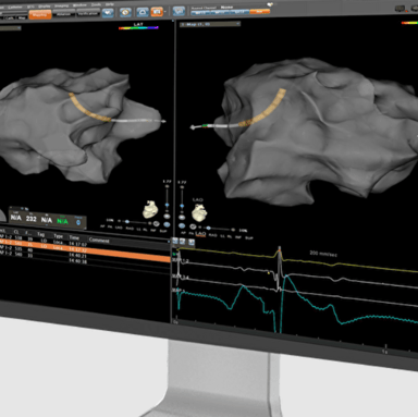 CARTO VIZIGO™ Bi-Directional Guiding Sheath | J&J MedTech US