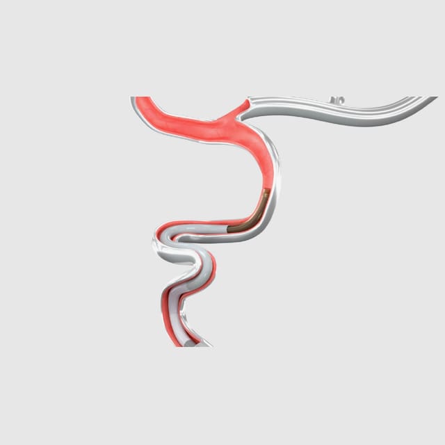 CEREBASE™ DA Guide Sheath | J&J MedTech US