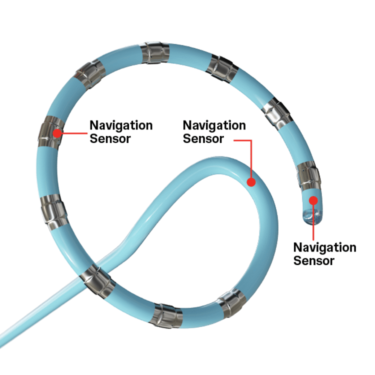 VARIPULSE™ Catheter | J&J MedTech US