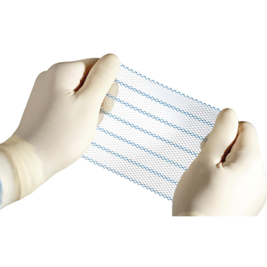 ULTRAPRO ADVANCED™ Macroporous Partially Absorbable Mesh | J&J MedTech US