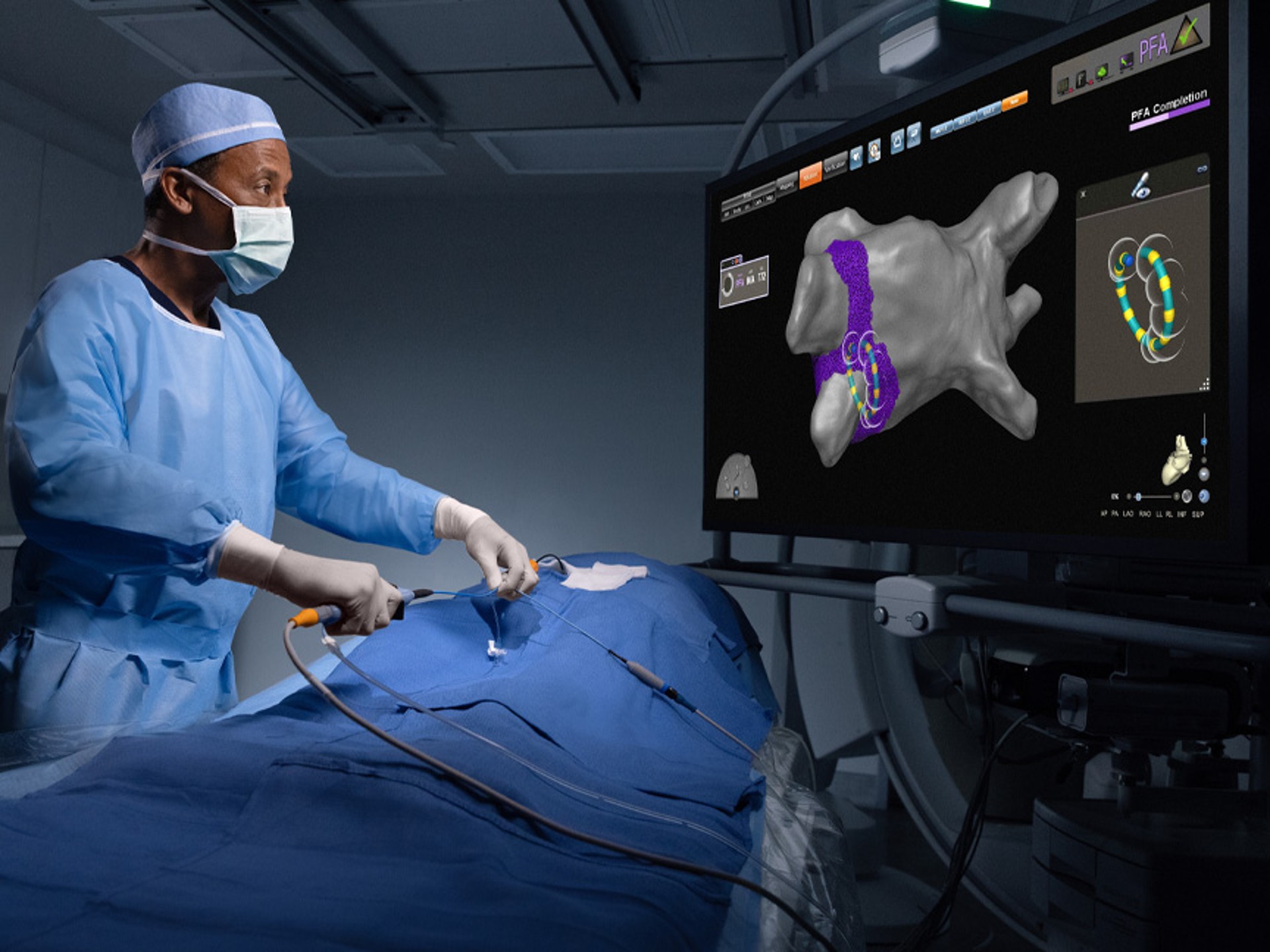 Pulsed field ablation (PFA) | J&J MedTech US