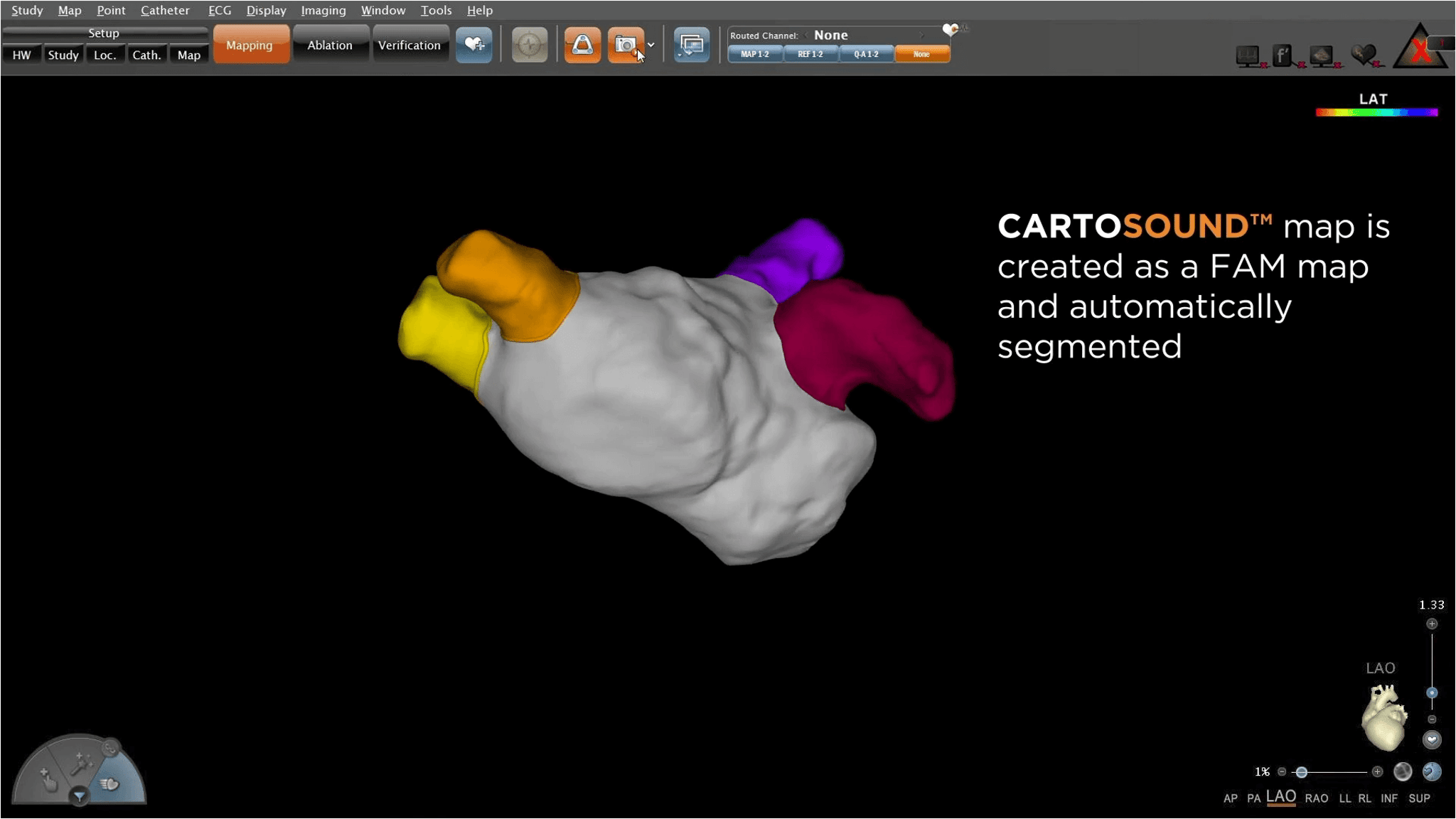 CARTOSOUND™ FAM Module | J&J MedTech US