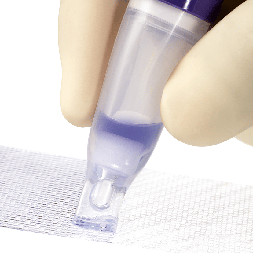 DERMABOND™ PRINEO™ Skin Closure System | J&J MedTech US