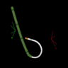 CARTO VIZIGO™ Bi-Directional Guiding Sheath | J&J MedTech US