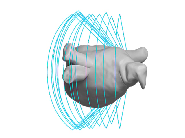 PASO™ Module | J&J MedTech US