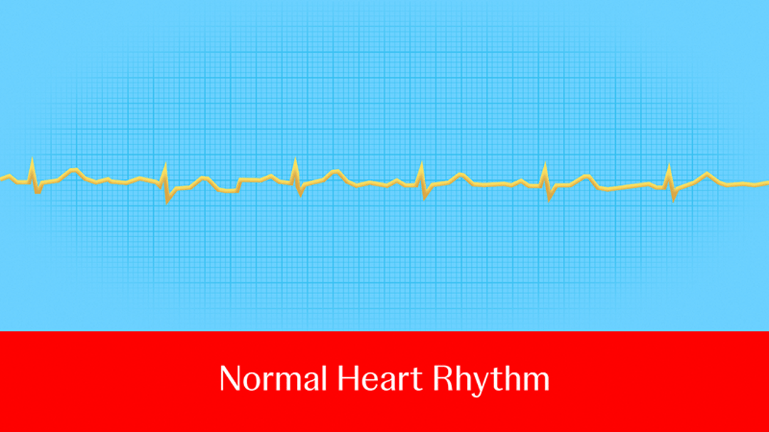 Ask an electrophysiologist: What roles do PFA and RFA play in the ...