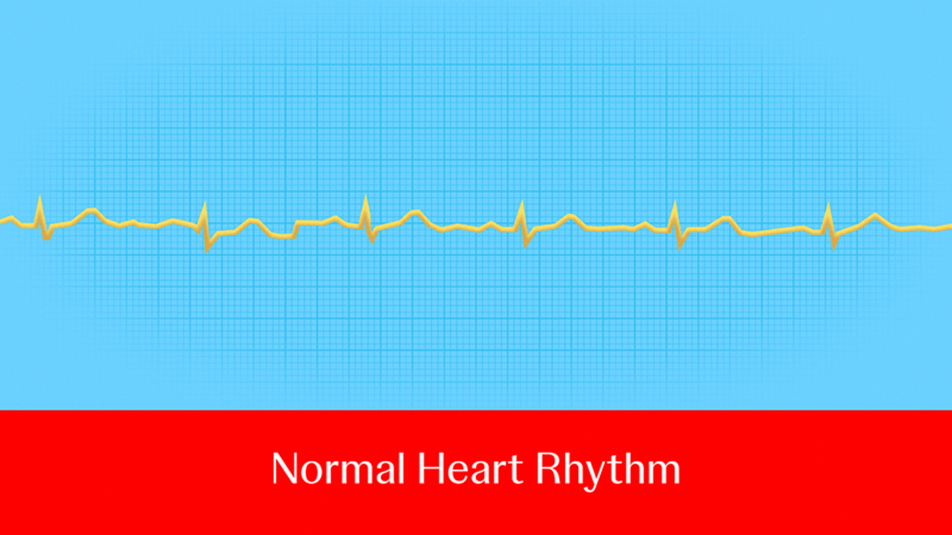 Ask an electrophysiologist: What roles do PFA and RFA play in the ...