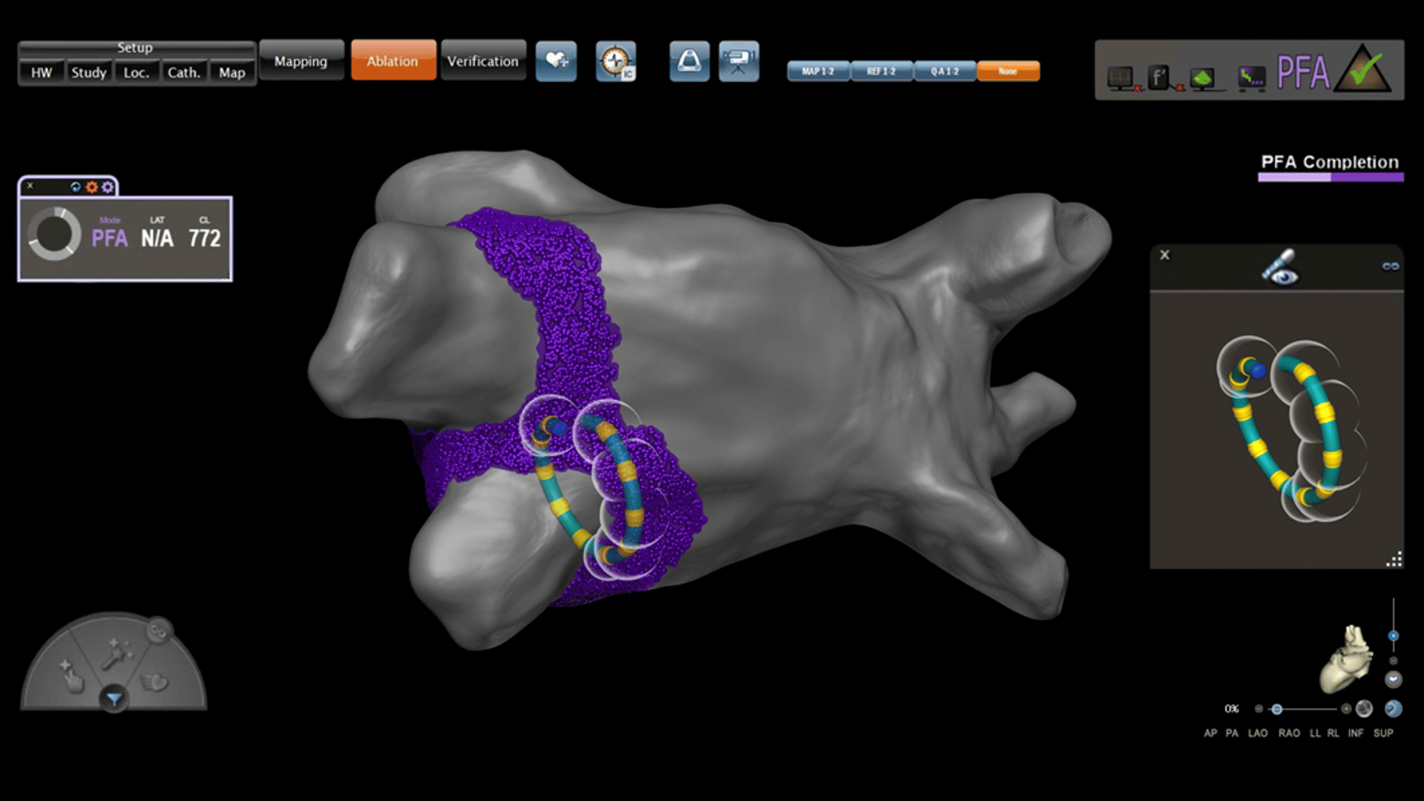 VARIPULSE™ Platform | J&J MedTech US