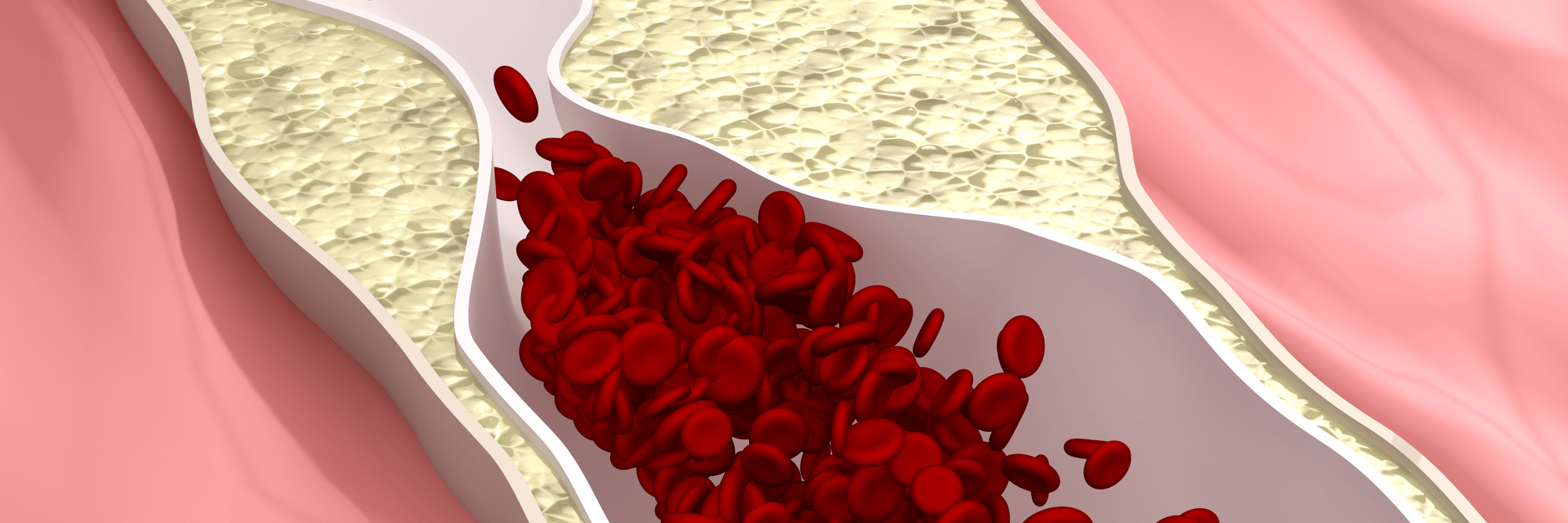 The Low down On Cholesterol Sanitarium Health Food Company The Low down On Cholesterol Sanitarium Health Food Company