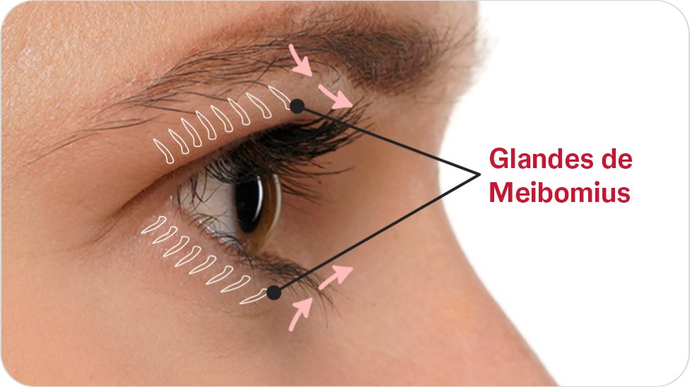 Qu'est-ce que le dysfonctionnement des glandes de Meibomius?