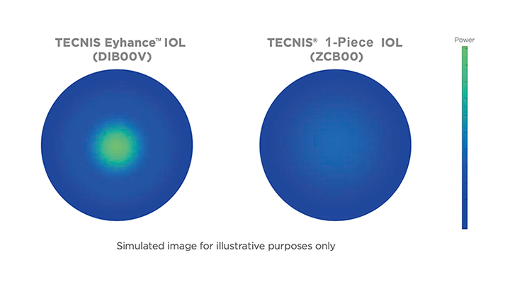TECNIS EYHANCE™ IOL | ジョンソン・ エンド・ ジョンソン ビジョン プロフェッショナル