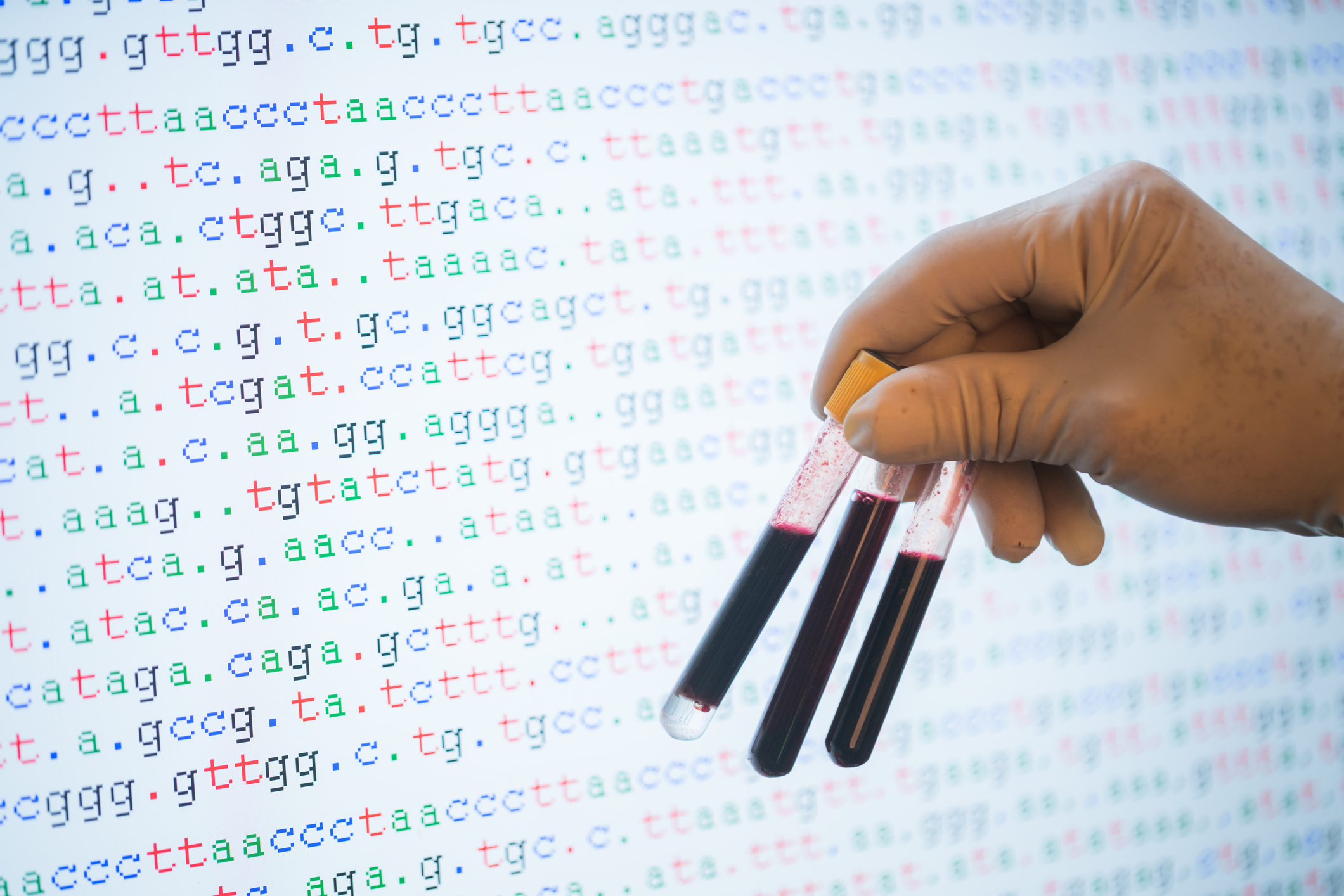 Sickle Cell Gene Therapy with CRISPR: An Overview of Gene Editing ...