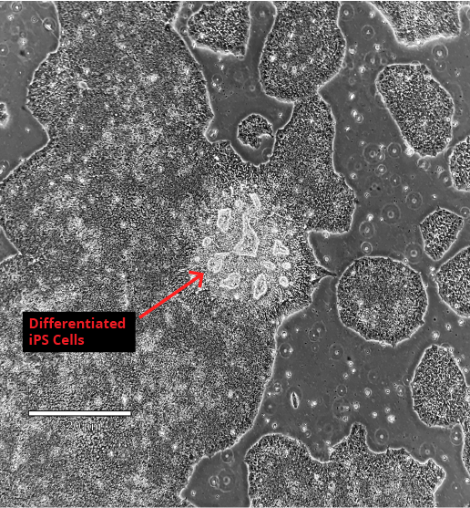 Overcoming Barriers of CRISPR Gene Editing in iPS Cells
