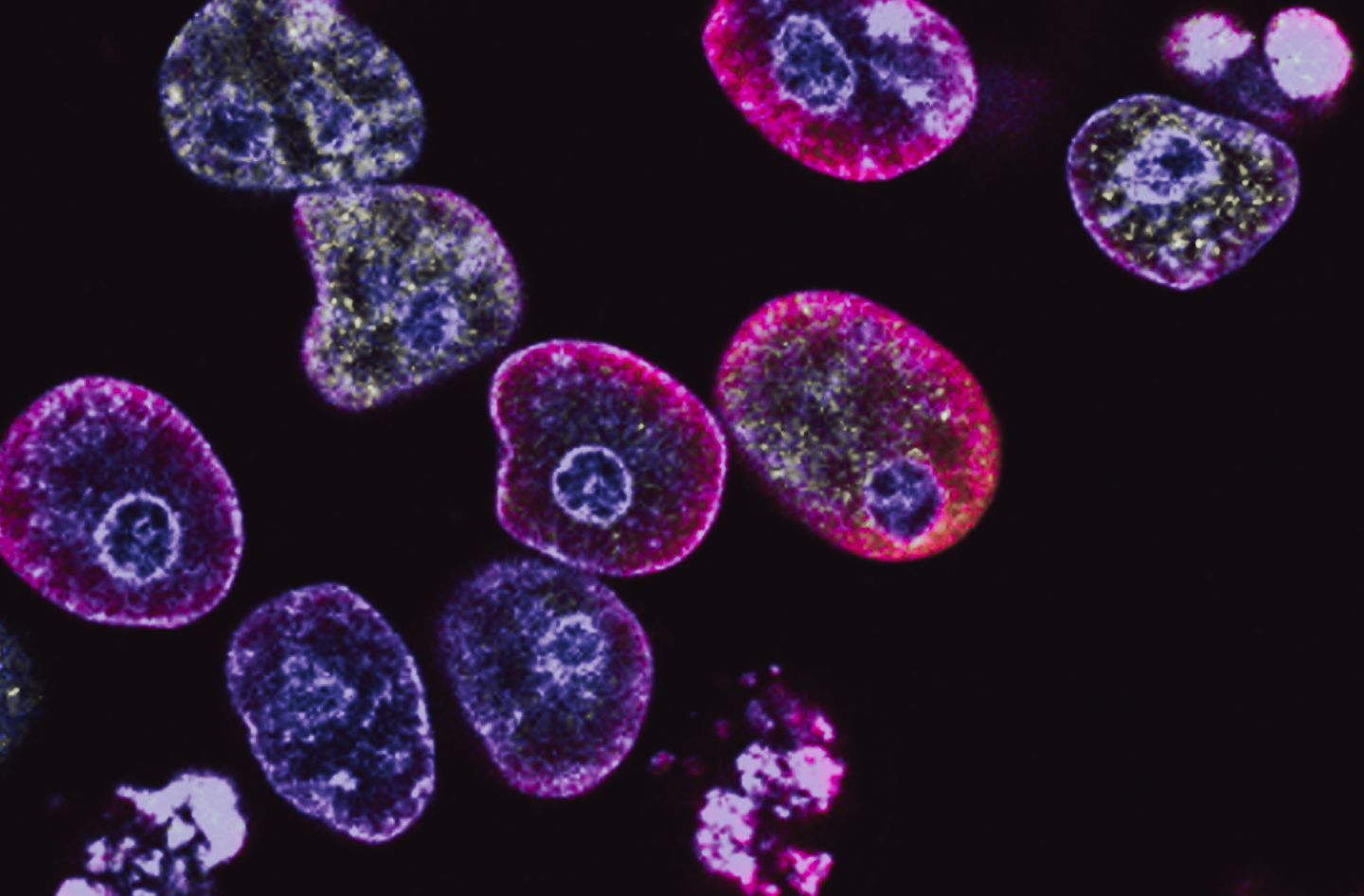 Under the Spotlight Wall St: Ginkgo Bioworks (DNA) | Stake