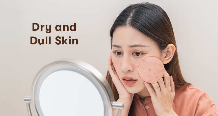 Dry and Dull Skin: Causes, Treatments and Prevention | Nutrition & Wellness