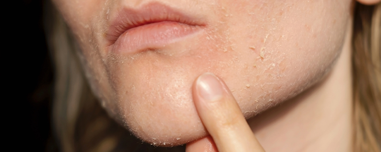 What Causes Itchy Skin? Prevent and Treat Skin Discomfort with These ...